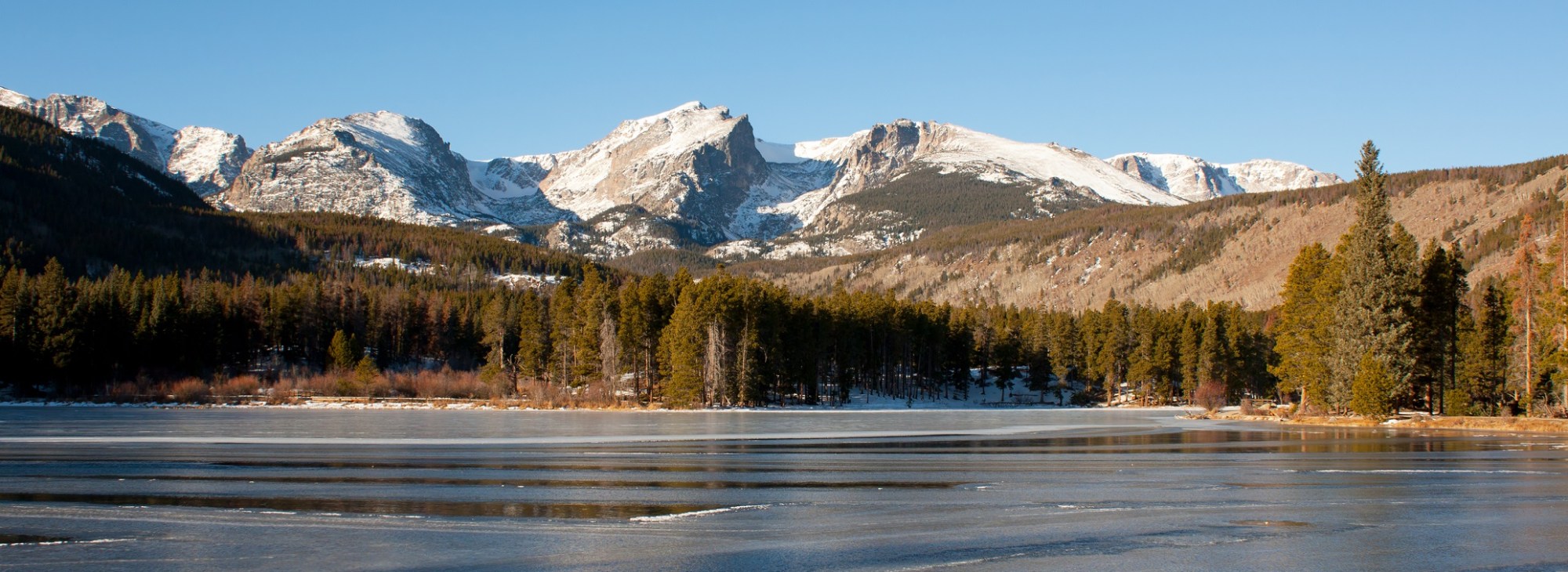 Dentist Lakewood CO | Cosmetic Dentistry